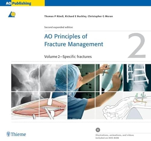 Pre-Owned AO Principles of Fracture Management: Vol. 1: Principles, Vol ...