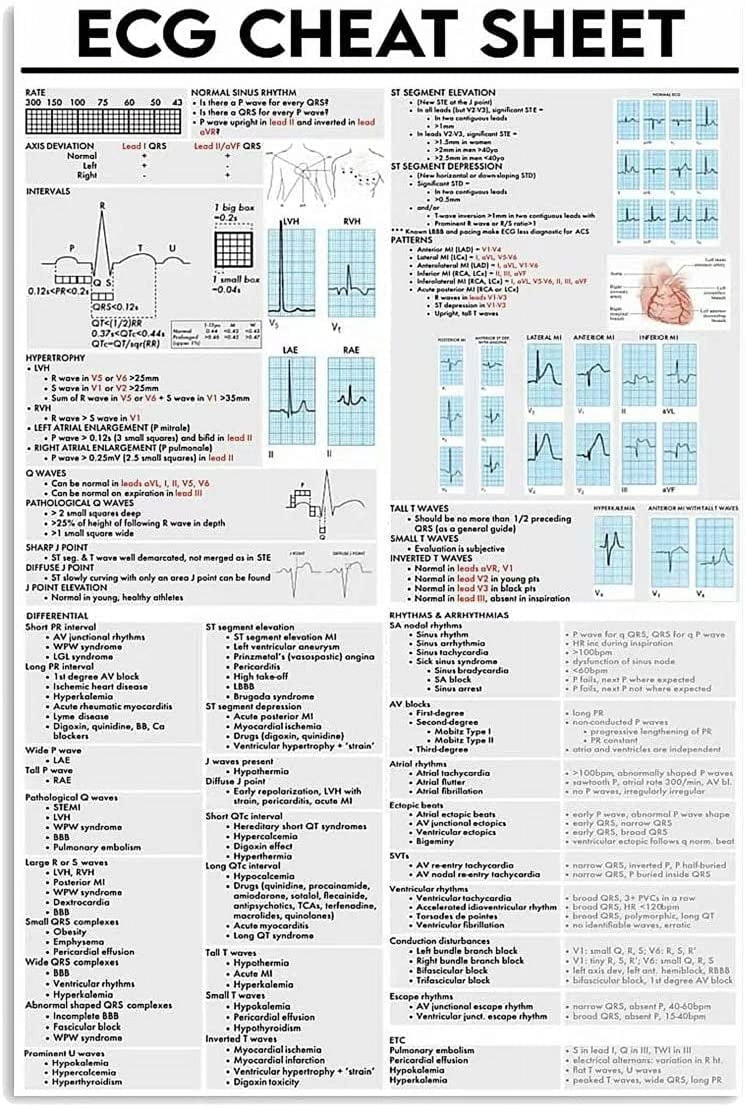 AVOI Ecg Cheat Sheet Posters Doctor'S Popular Science Guide Metal Signs ...