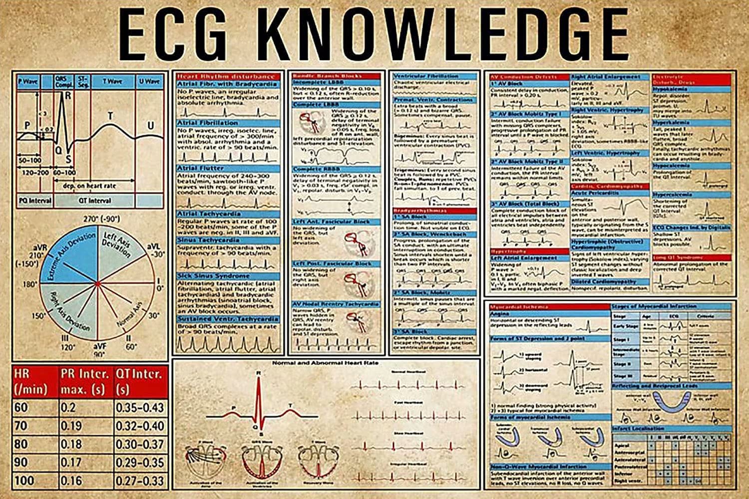 AVOI Ecg Knowledge Metal Signs Doctor Chart Guide Posters Room Decor ...