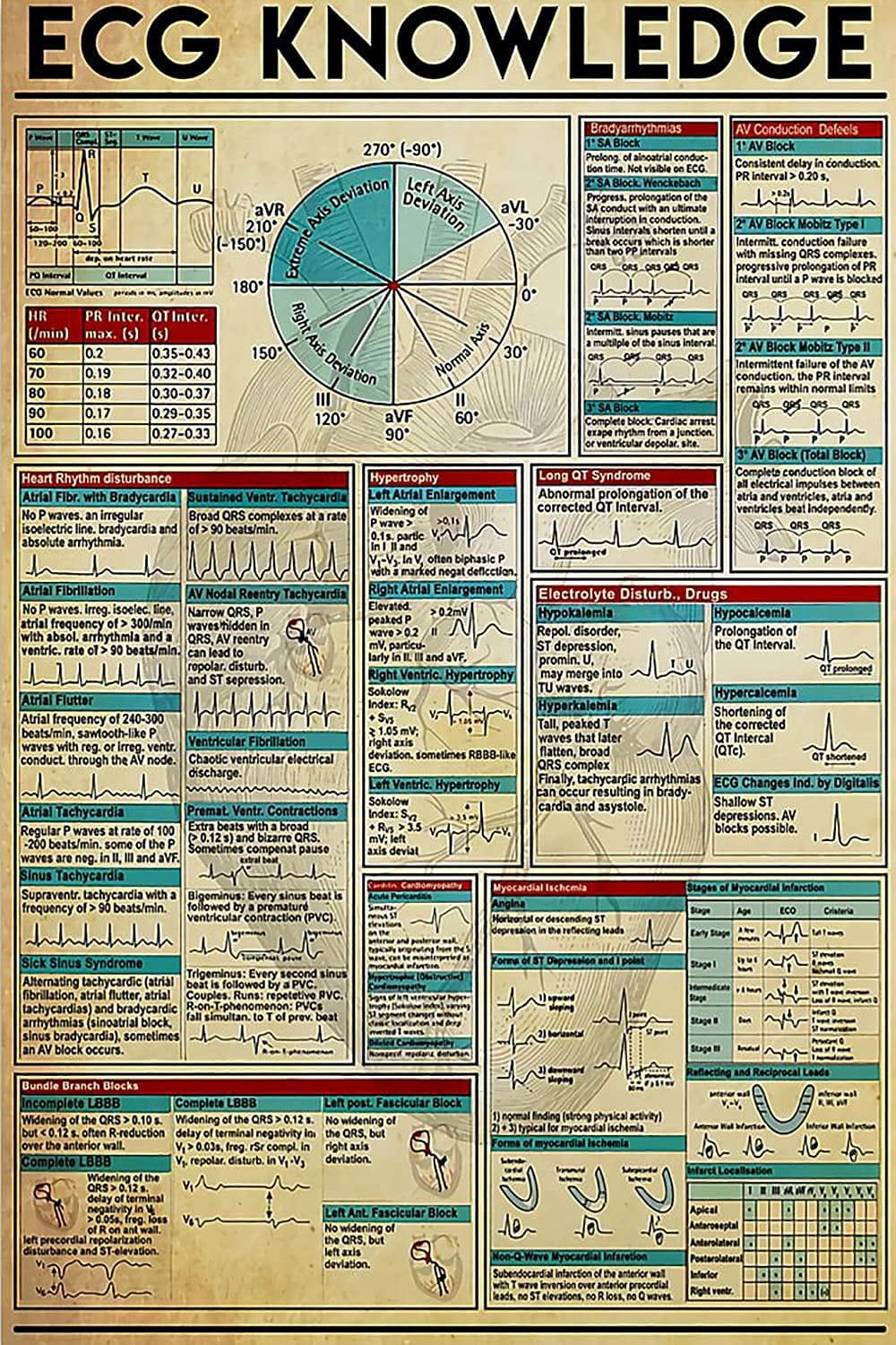 AVOI Ecg Knowledge Posters Cardiology Popular Science Guide Metal Signs ...