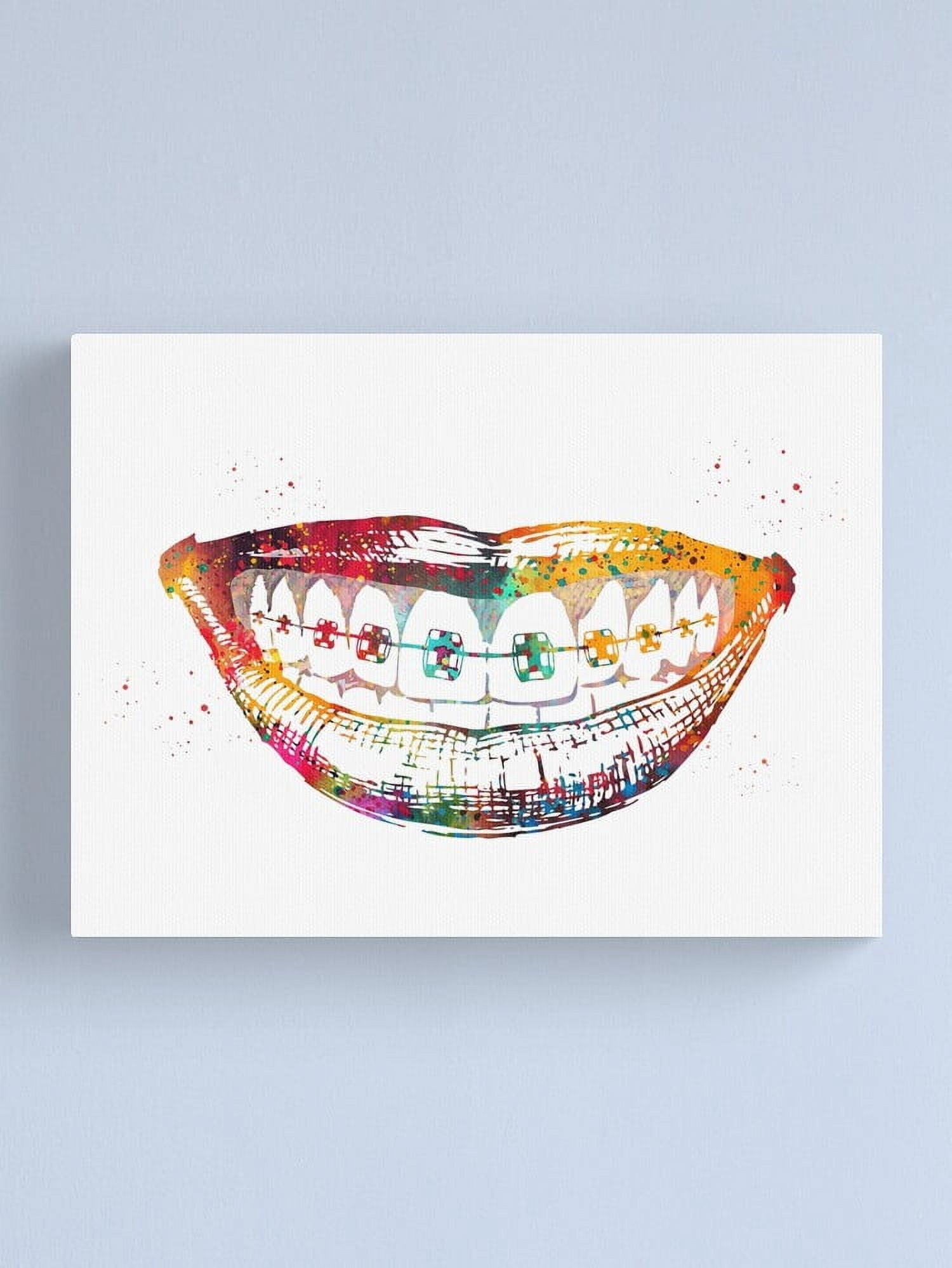 Aaroca Teeth braces Canvas Print (Unframed) Classic Decoration for ...