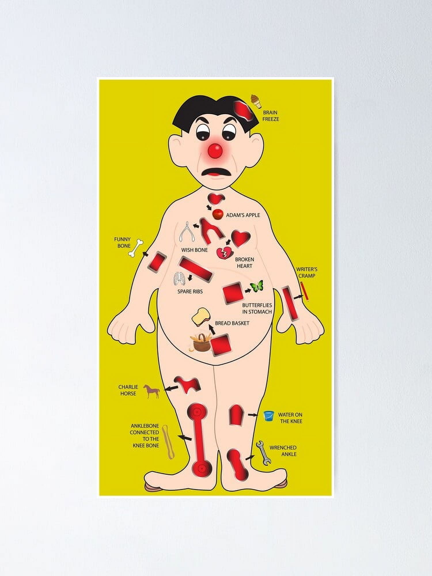 Aaroca new OPERATION board game man - raise a smile for those in ...