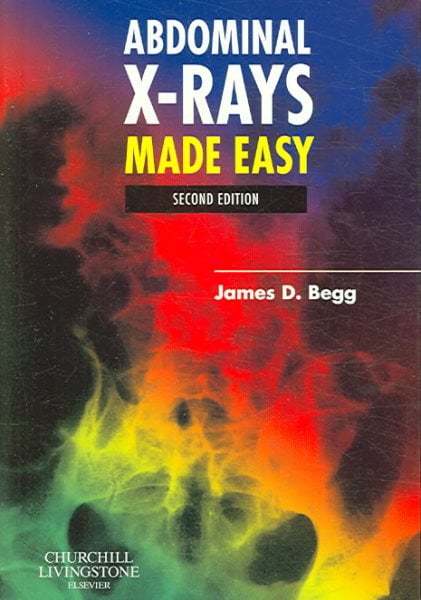 Abdominal X-rays Made Easy - Walmart.com