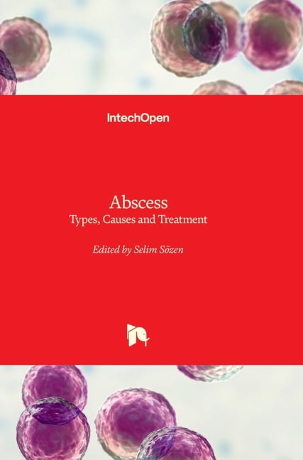 Abscess - Types, Causes and Treatment: Types, Causes and Treatment ...