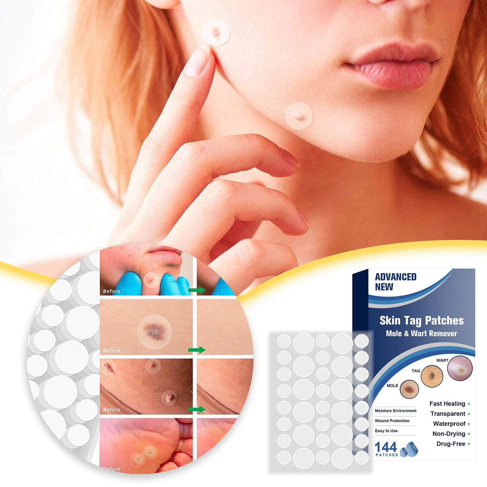 Absorbent Hydrocolloid Pimple Fast 144 Of And Wart Removal For ...