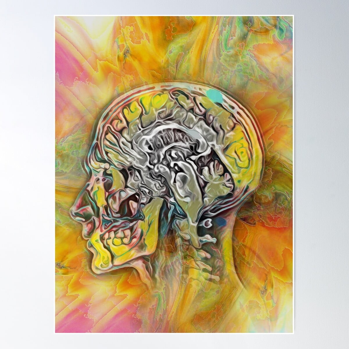 Abstract Mri Brain Poster Wall Art, Modern Wall Decor For Living Room ...