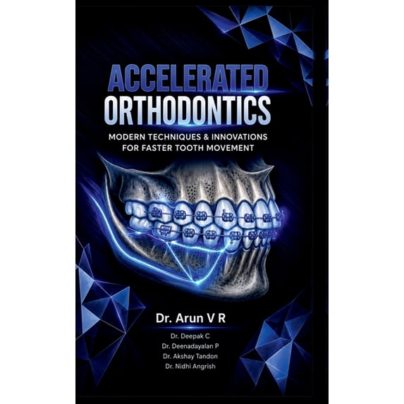 Accelerated Orthodontics: Modern Techniques & Innovations for Faster ...