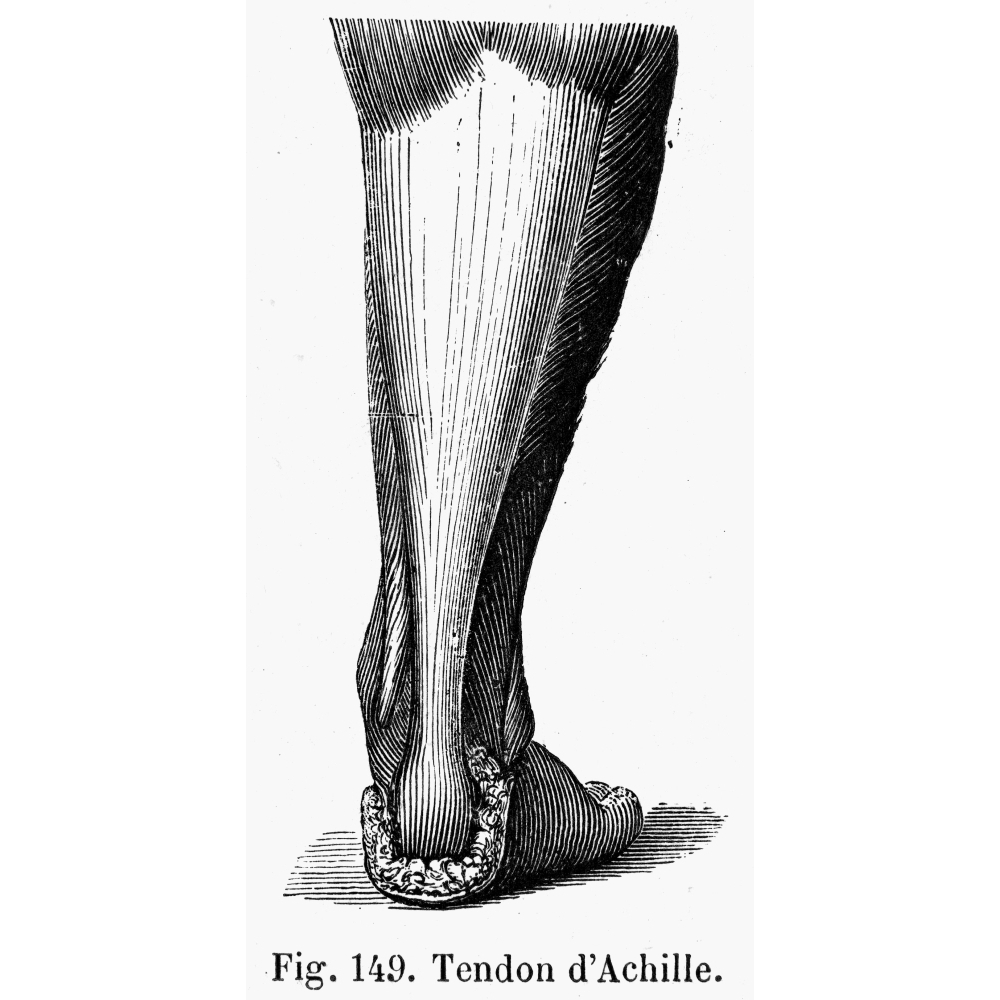 Achilles Tendon. /Nline Engraving, French, 19Th Century. Poster Print ...