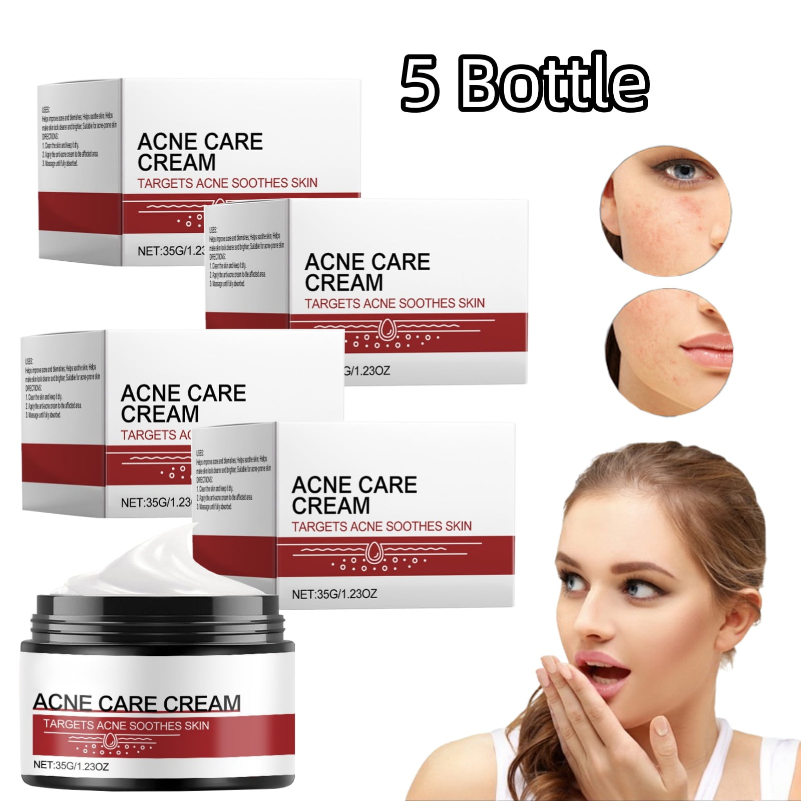 Acne Cream, Powerful Face Care Cream Dry Face Care Instantly Moisturize ...