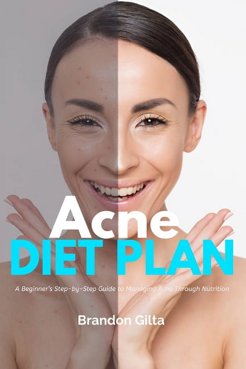 Acne Diet Plan: A Beginner's Step-by-Step Guide to Managing Acne ...