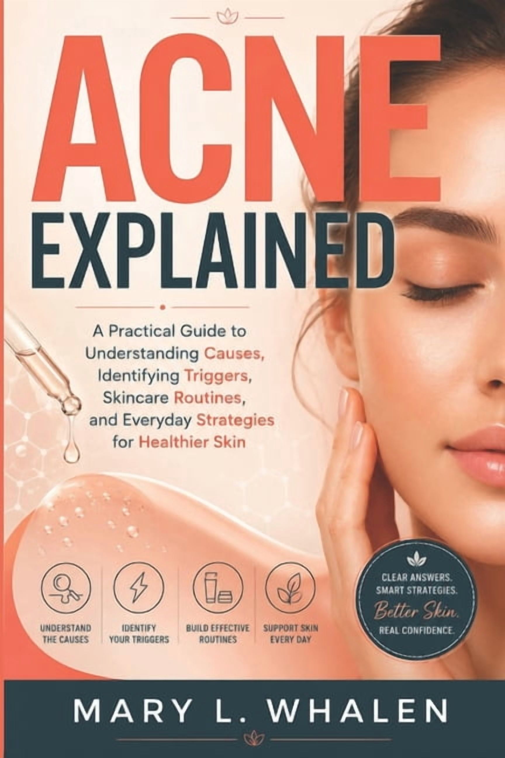 Acne Explained: A Practical Guide to Understanding Causes, Identifying ...