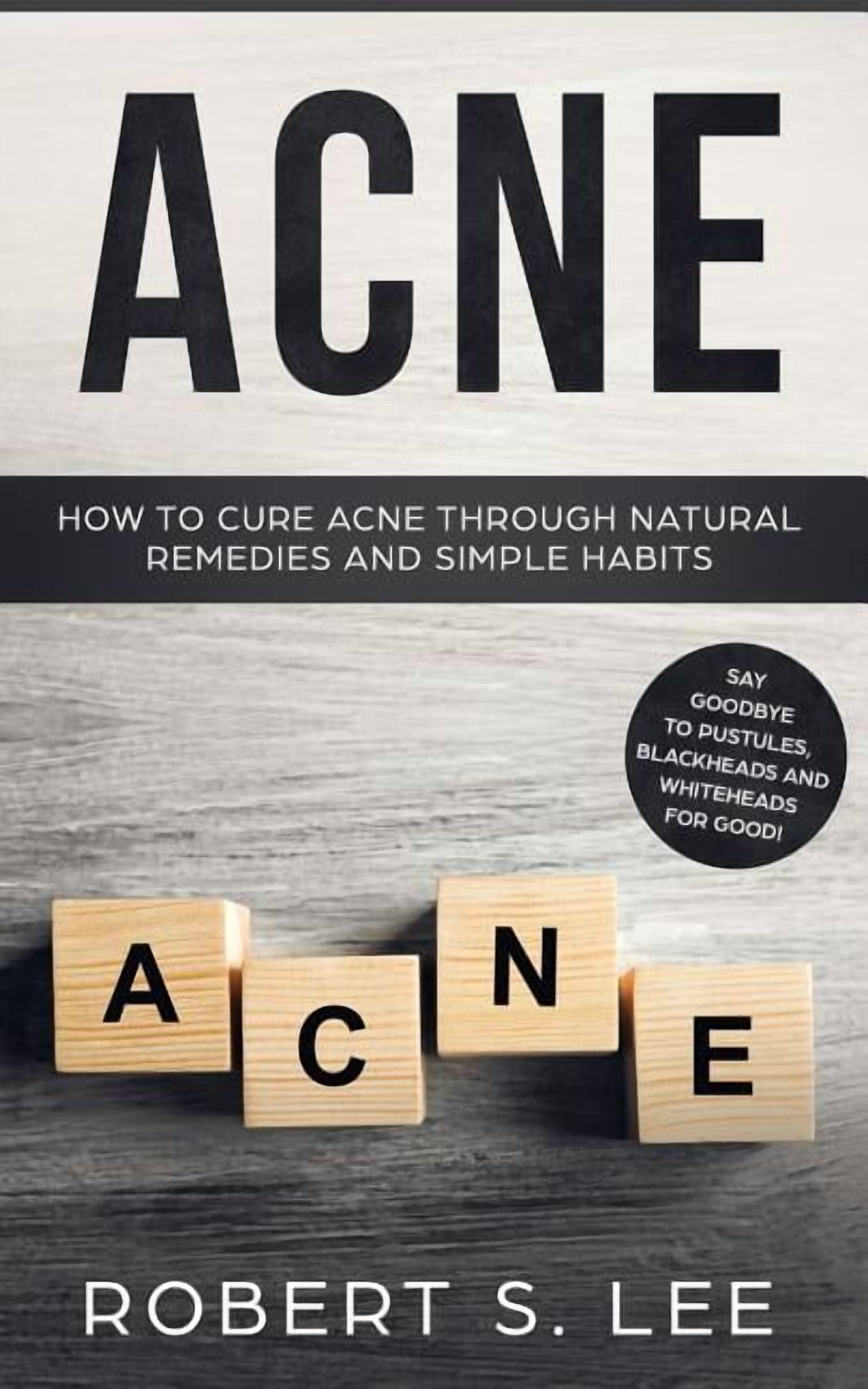Acne: How to Cure Acne through Natural Remedies and Simple Habits. Say ...