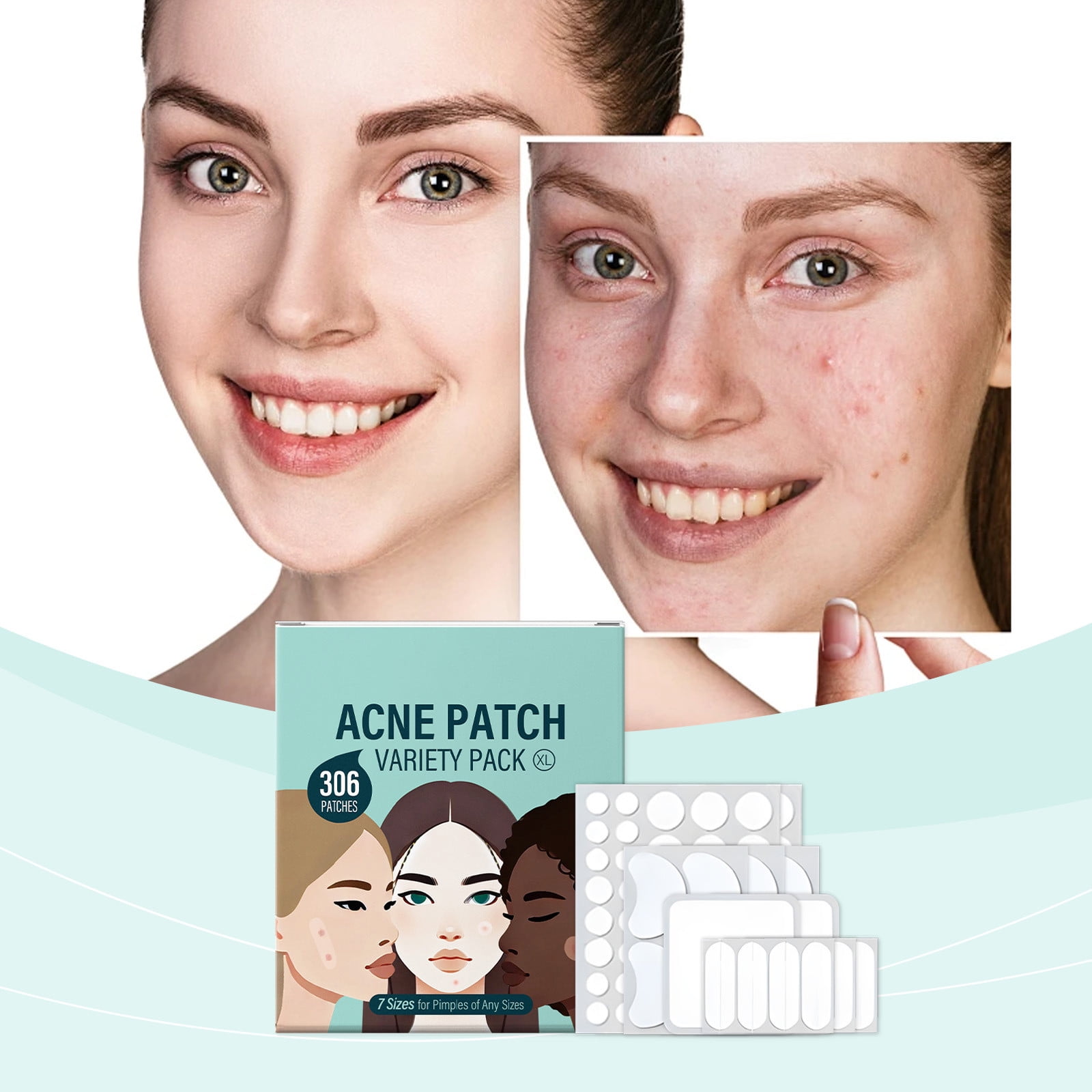 Acne Patch Variety Pack, Various Shapes of Acne Patches Acne Patches ...