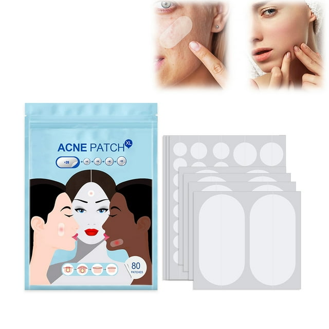 Acne Pimple Patches 5 Sizes Acne Patches Waterproof Hydrocolloid Acne ...