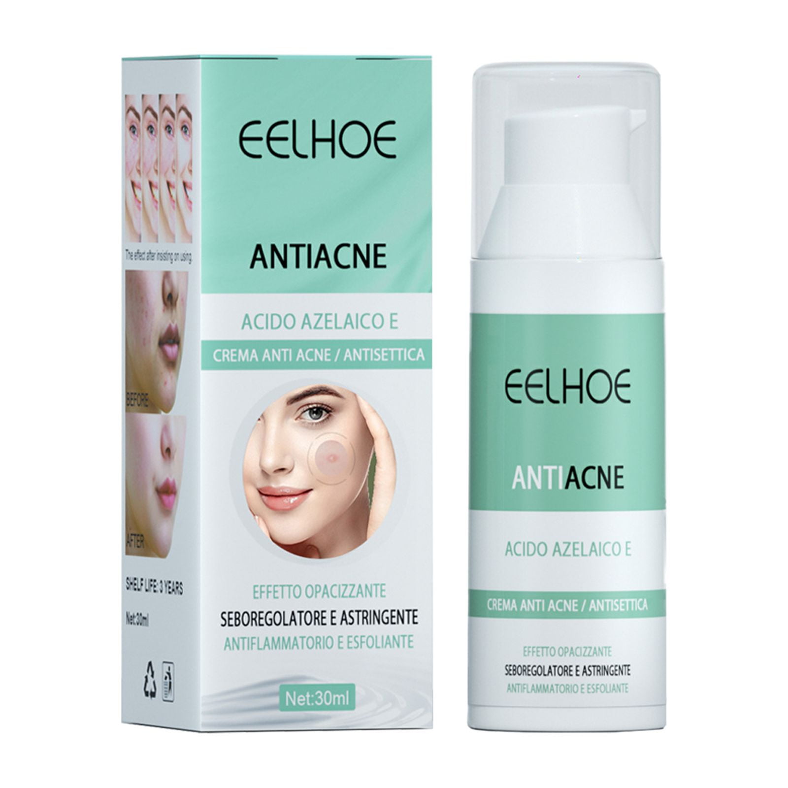 Acne Removal Cream 30ml Pimple Remove Treatment Mark Fading ...