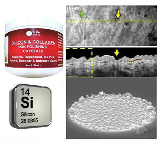 Acne Scars Silicon & Collagen Skin Polishing Crystals Gel For Indented ...