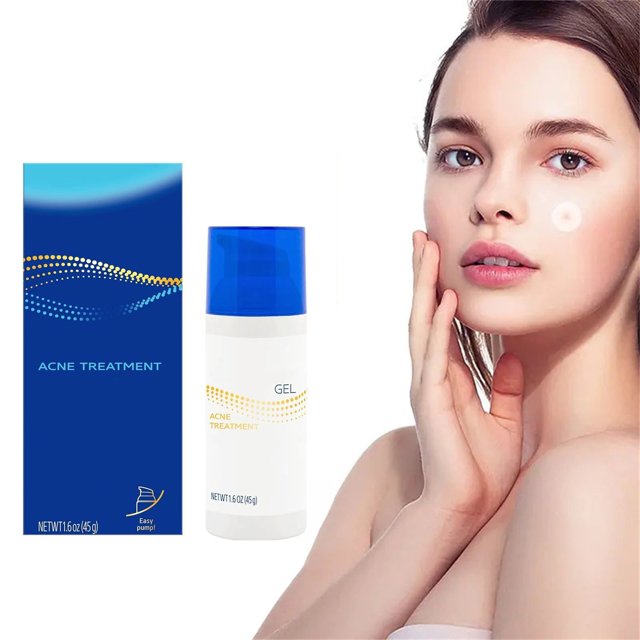 Acne Treatment Gel, Mild Skin Care For Acne Prone Sensitive Skin Gel ...