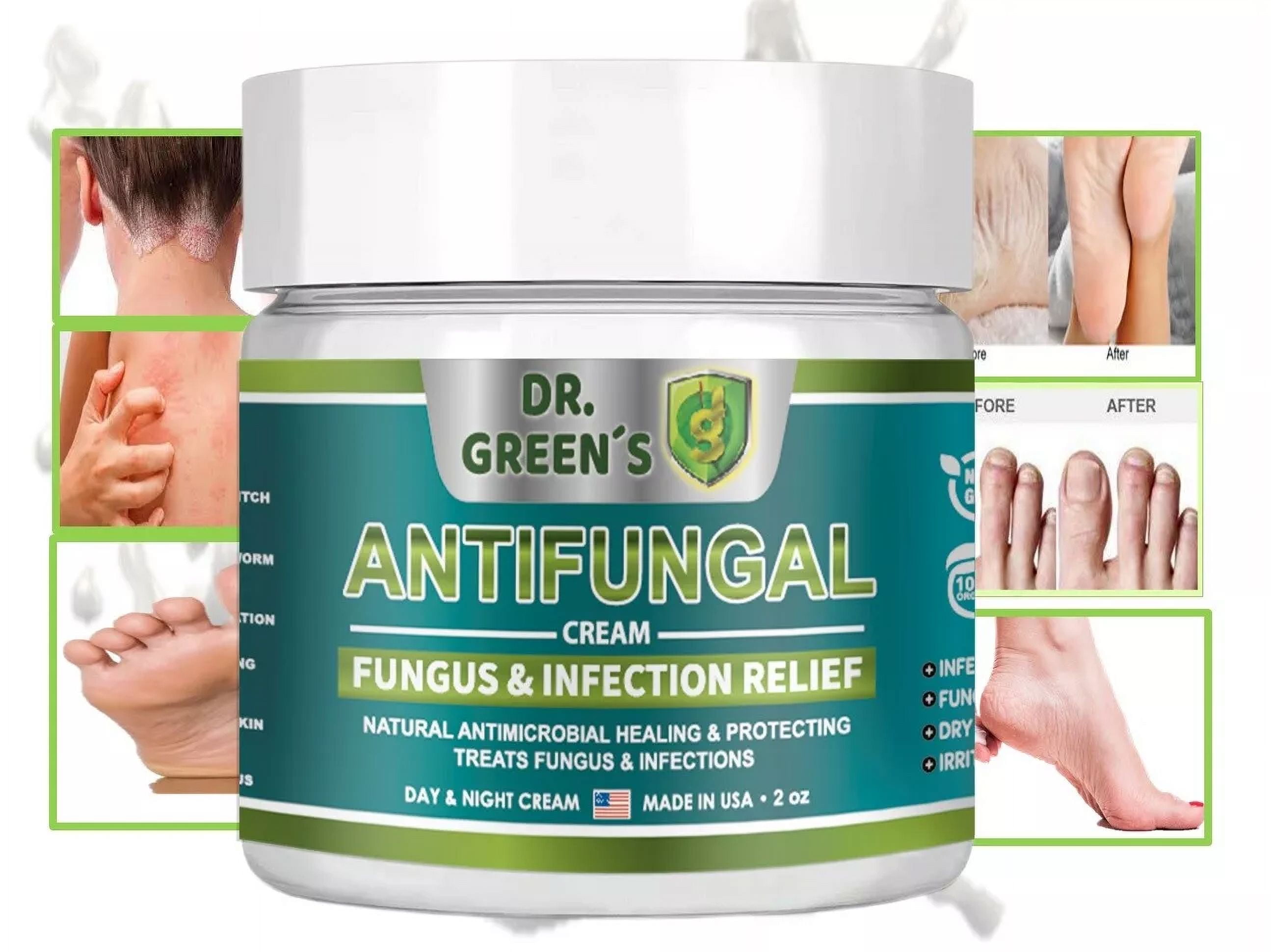 Acrolt Natural Antifungal Toenail Nail Fungus support Cream ringworm ...