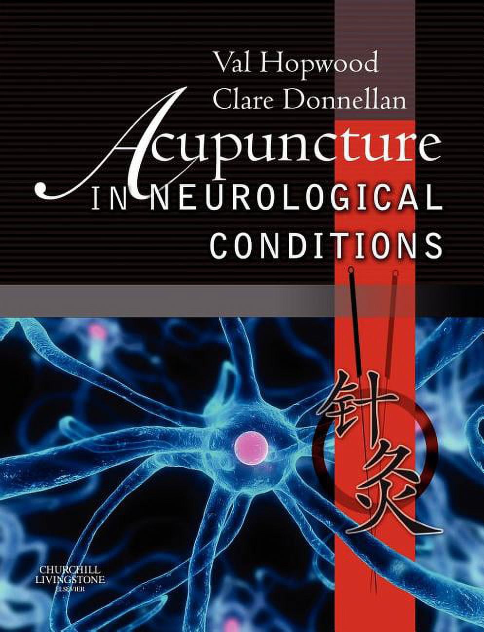 Acupuncture in Neurological Conditions Paperback - Walmart.com