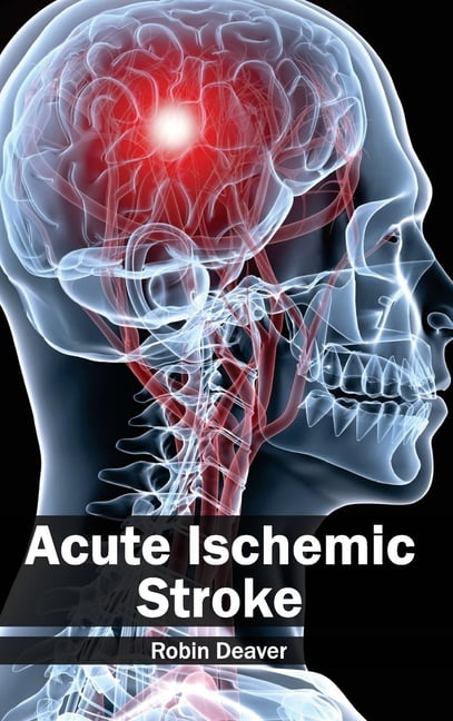 Acute Ischemic Strokes