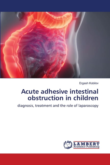 Acute adhesive intestinal obstruction in children (Paperback) - Walmart.com