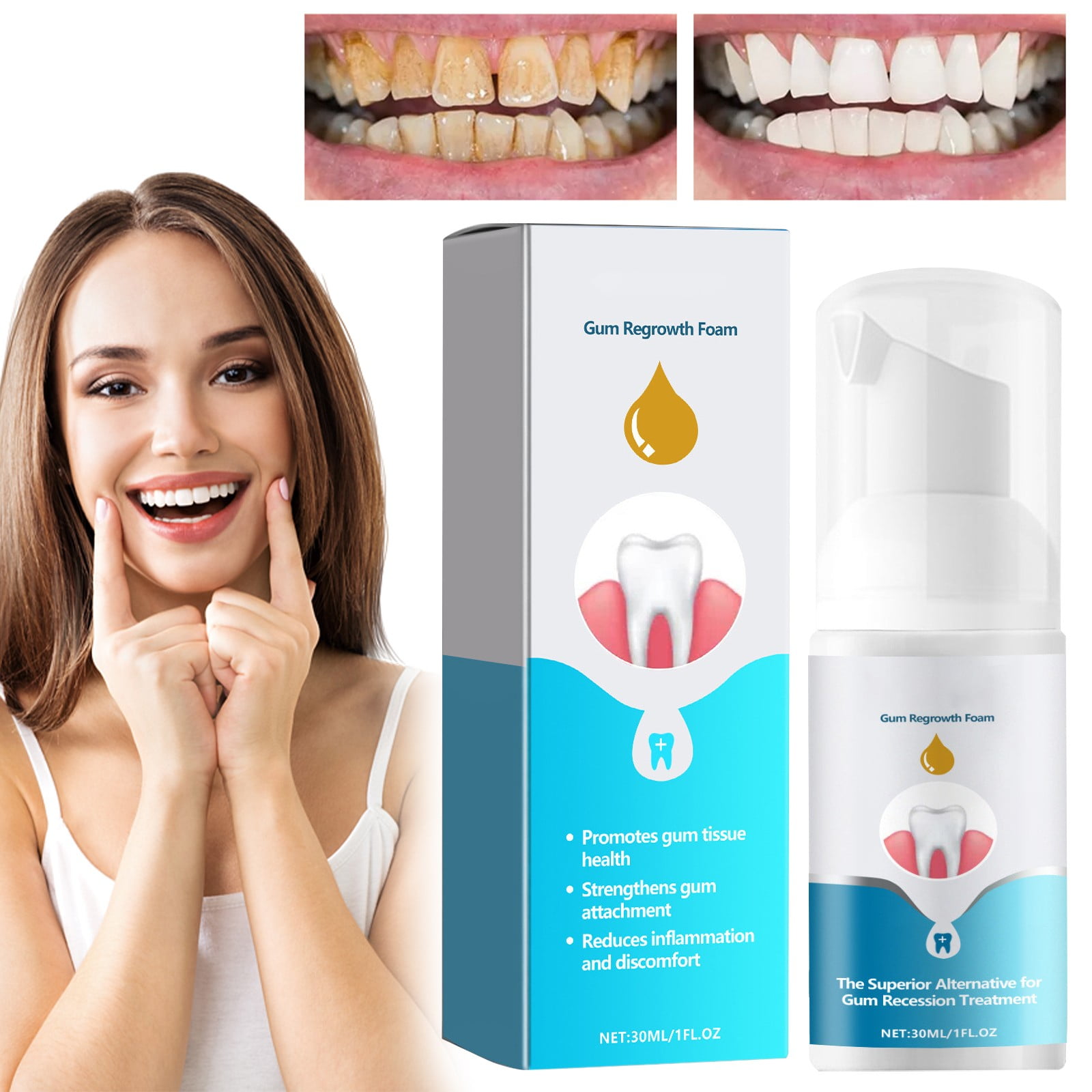 Adapan Foam Whitening Toothpaste,Gum Care,Health Teeth,Gums Regrowth ...