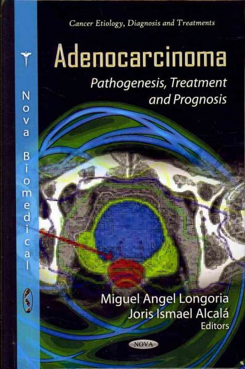 Adenocarcinoma (Hardcover) by Miguel Angel Longoria - Walmart.com