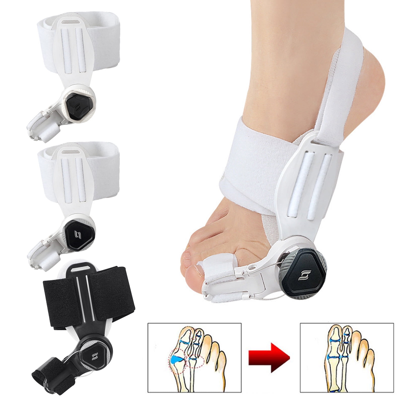 Adjustable Bunion Splint with Hallux Valgus Correction and Orthopedic ...