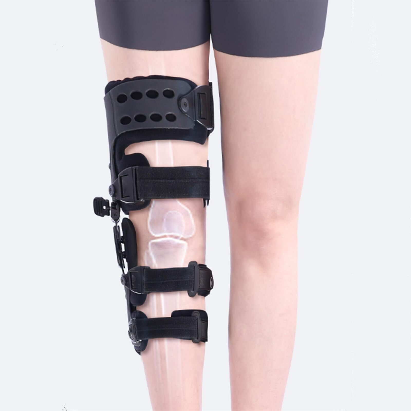 Adjustable leg correction straps for children and adults, X-shaped bow ...