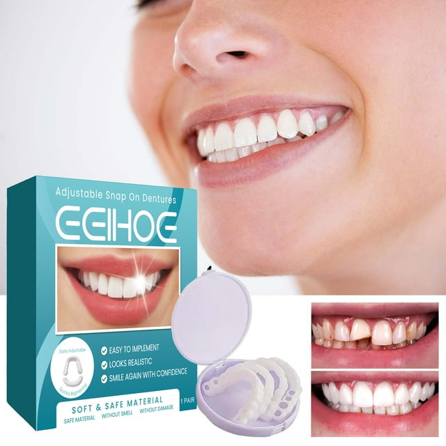 Adjustable snap-on dentures, temporary fillings, gap fillings ...