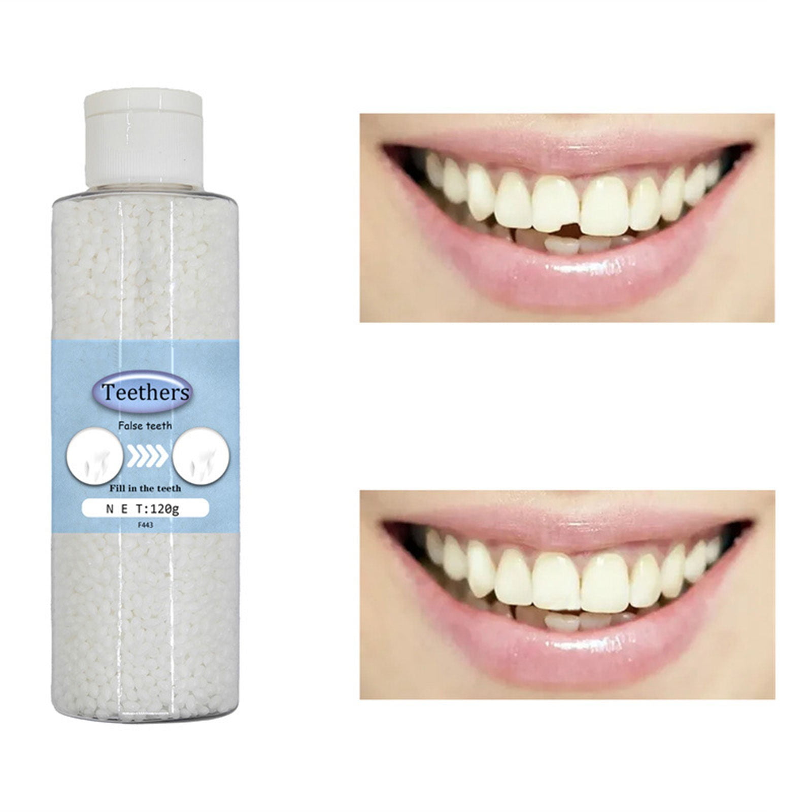 Adpan Plastic Teeth Glue Makeup Dentures Modified Temporary Filling ... Adpan Plastic Teeth Glue Makeup Dentures Modified Temporary Filling ...