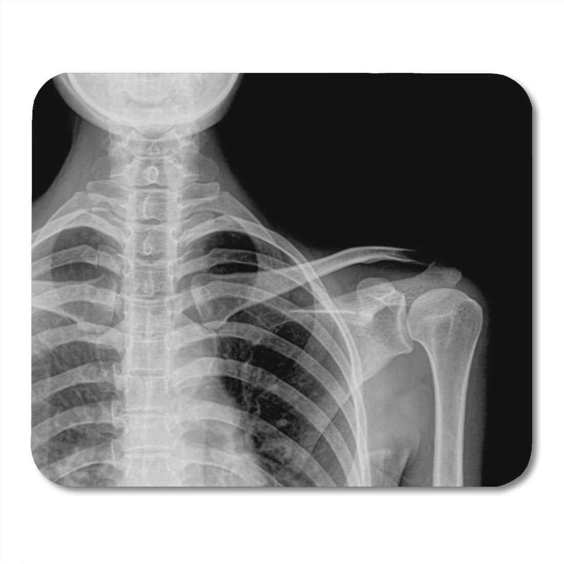 Conbicy Rubber Adult X Rays Mouse Pad, Multi-Color - Walmart.com