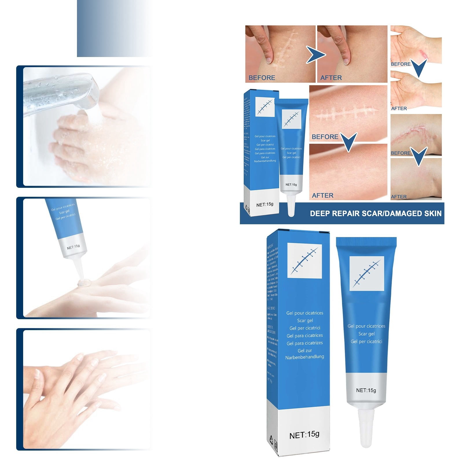 Advanced Formula Scar Gel with Polyglycerols Silicone Oil Illicium Leaf ...