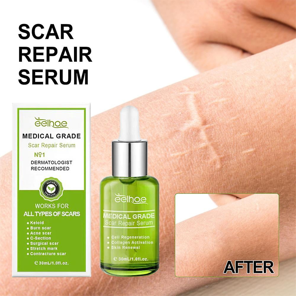 Advanced Scar Repair Serum, Medical Grade Scar Repair Serum For All ...
