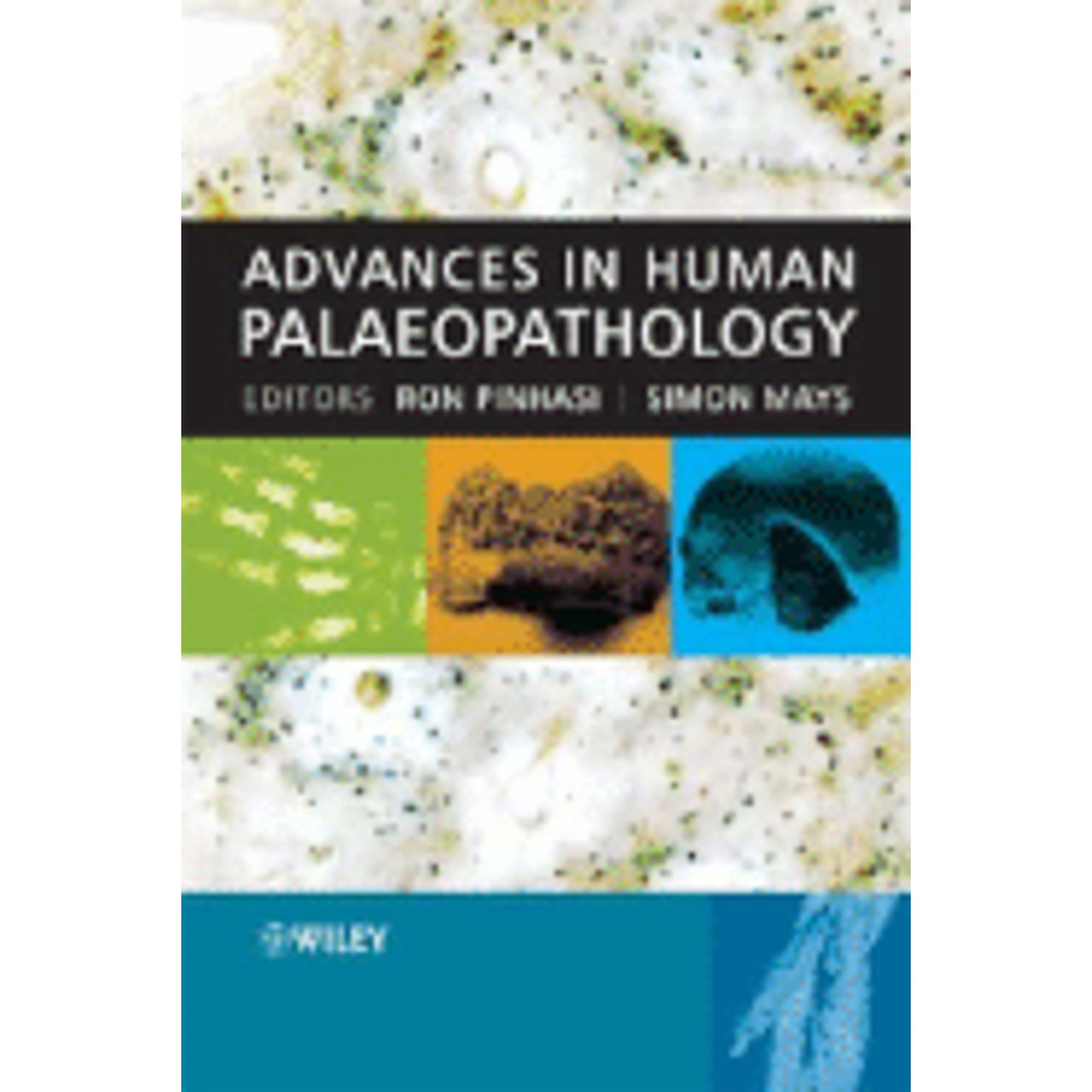 Pre-Owned Advances in Human Palaeopathology (Hardcover 9780470036020 ...