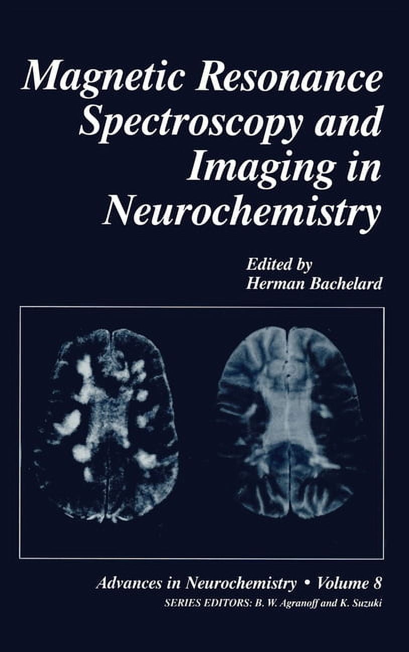 Advances in Neurochemistry Magnetic Resonance Spectroscopy and Imaging ...