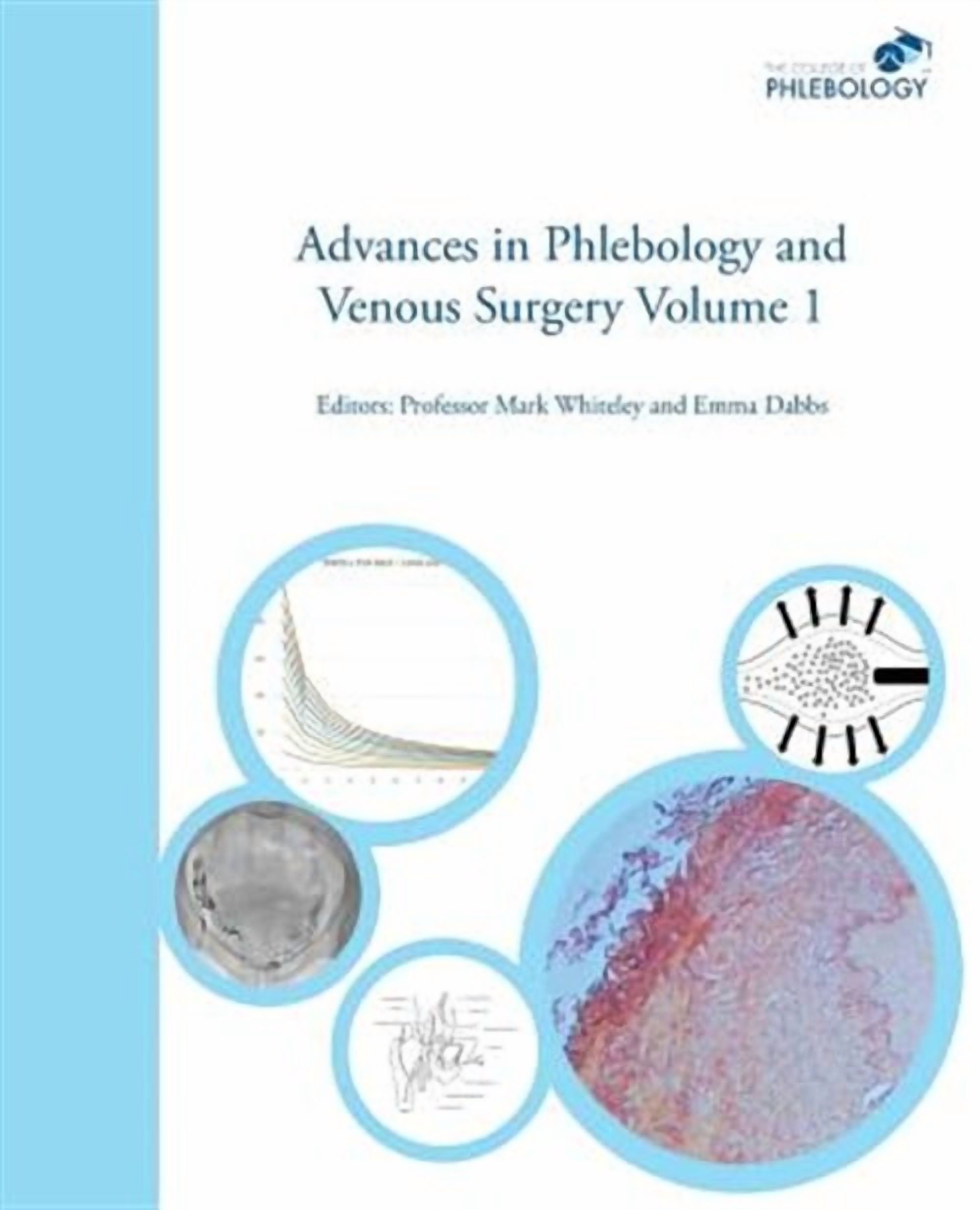 Advances in Phlebology and Venous Surgery: Advances in Phlebology and ...