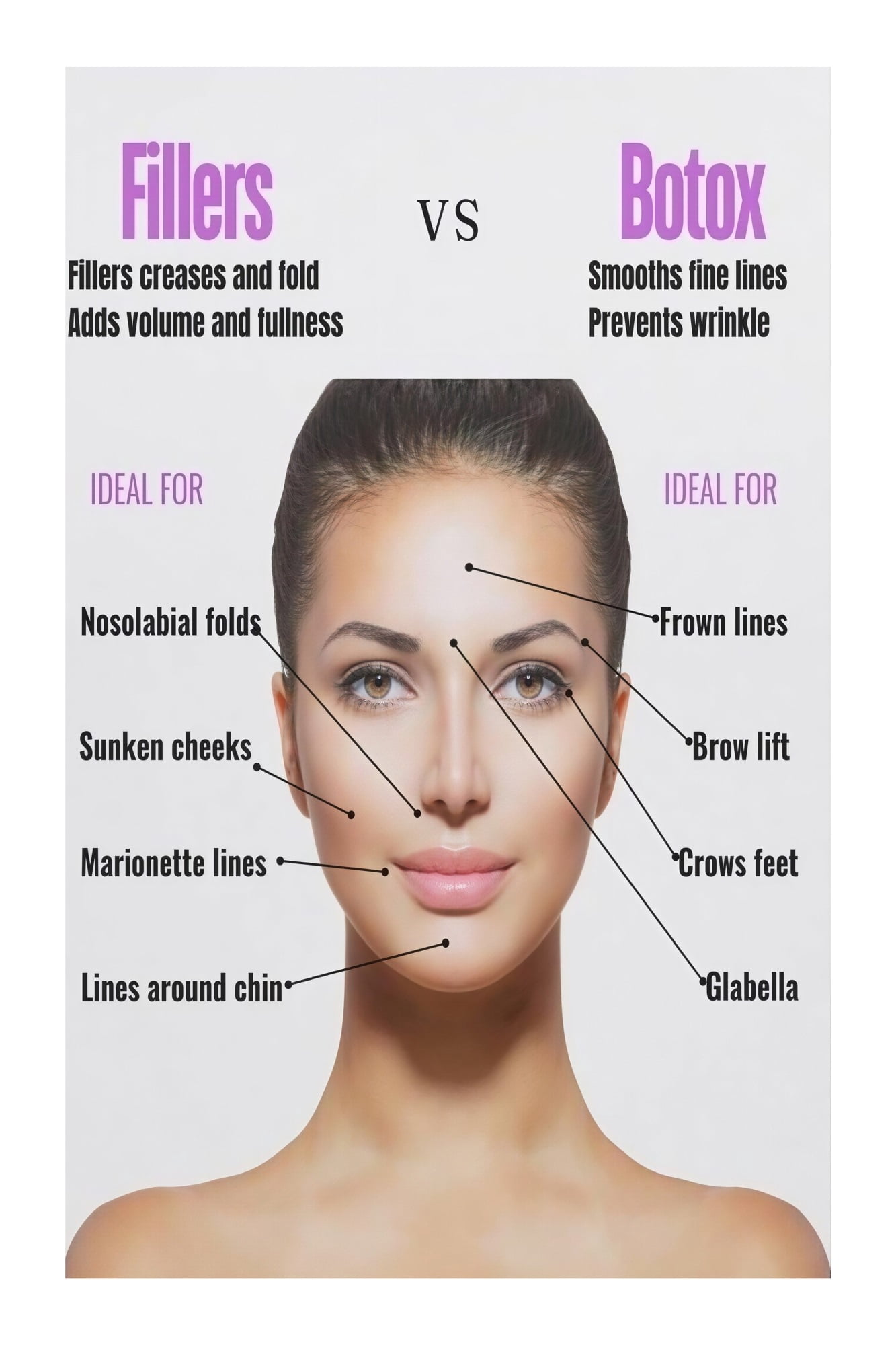 Aesthetic Injectables Comparison Chart Neurotoxin vs Filler Guide for ...