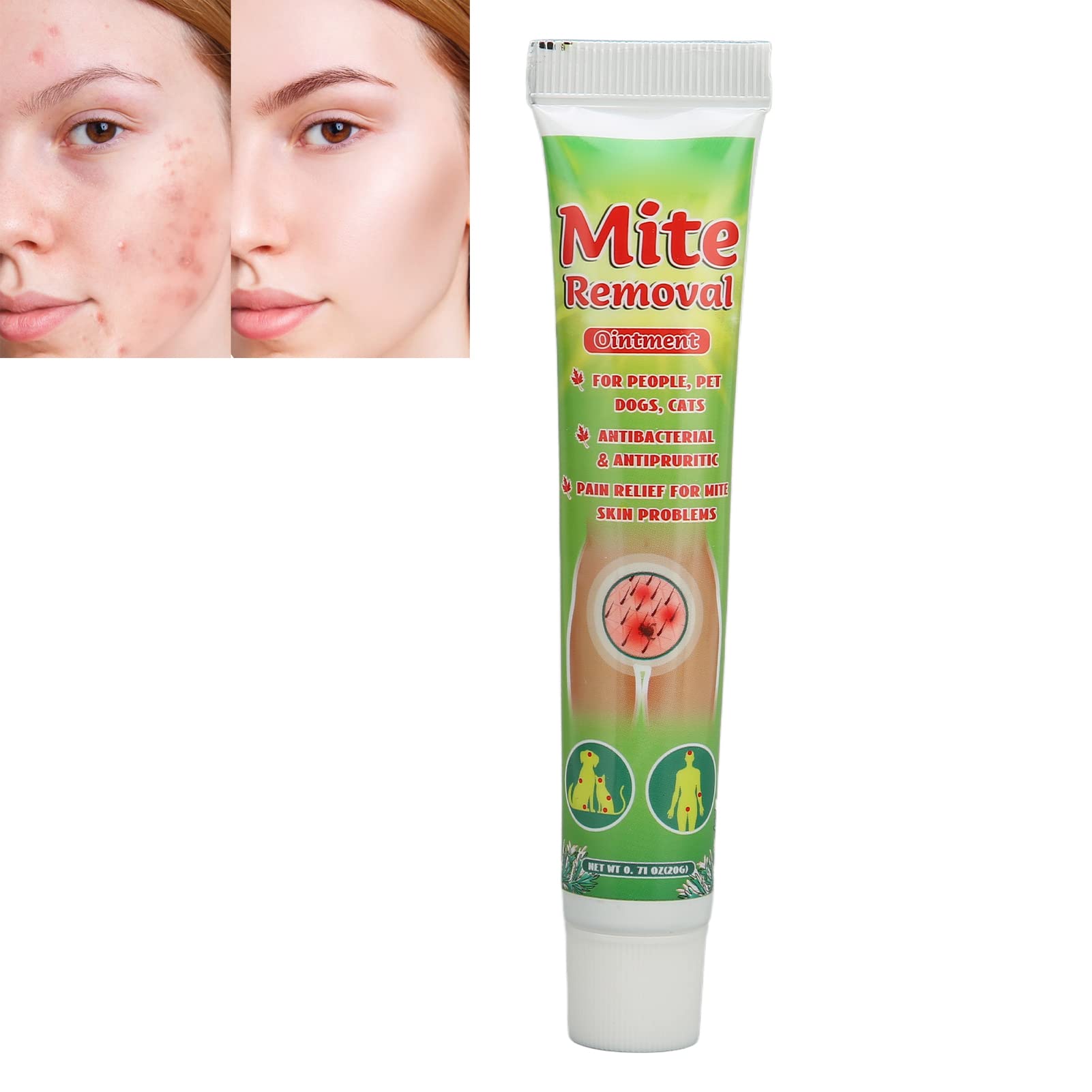 After Bite Advanced Formula, Bed Bug Killer Itch Relief, Ideal for Mite ...