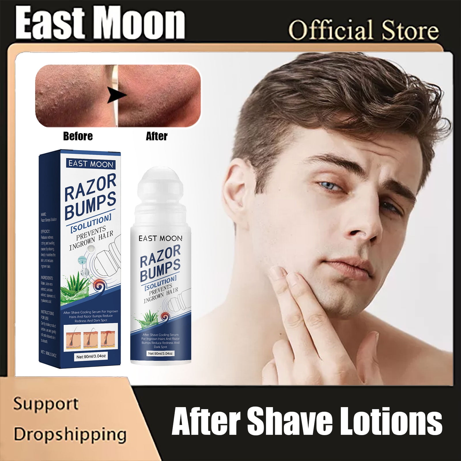 After Shave Repair Lotions Prevent Ingrowns Hair Treatment Smooth Body ...