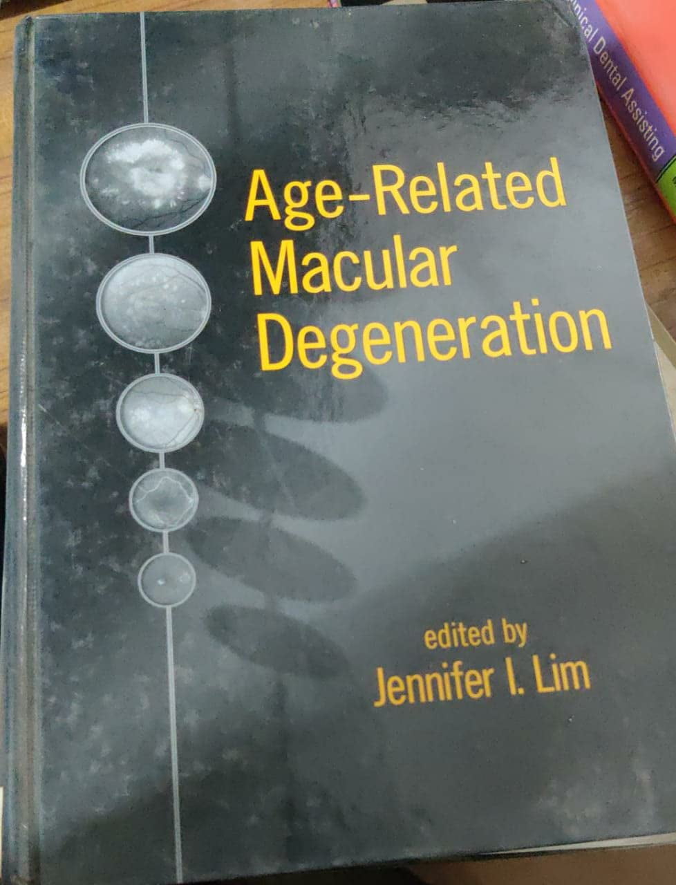 Age-Related Macular Degeneration - Lim, Jennifer I. - Walmart.com