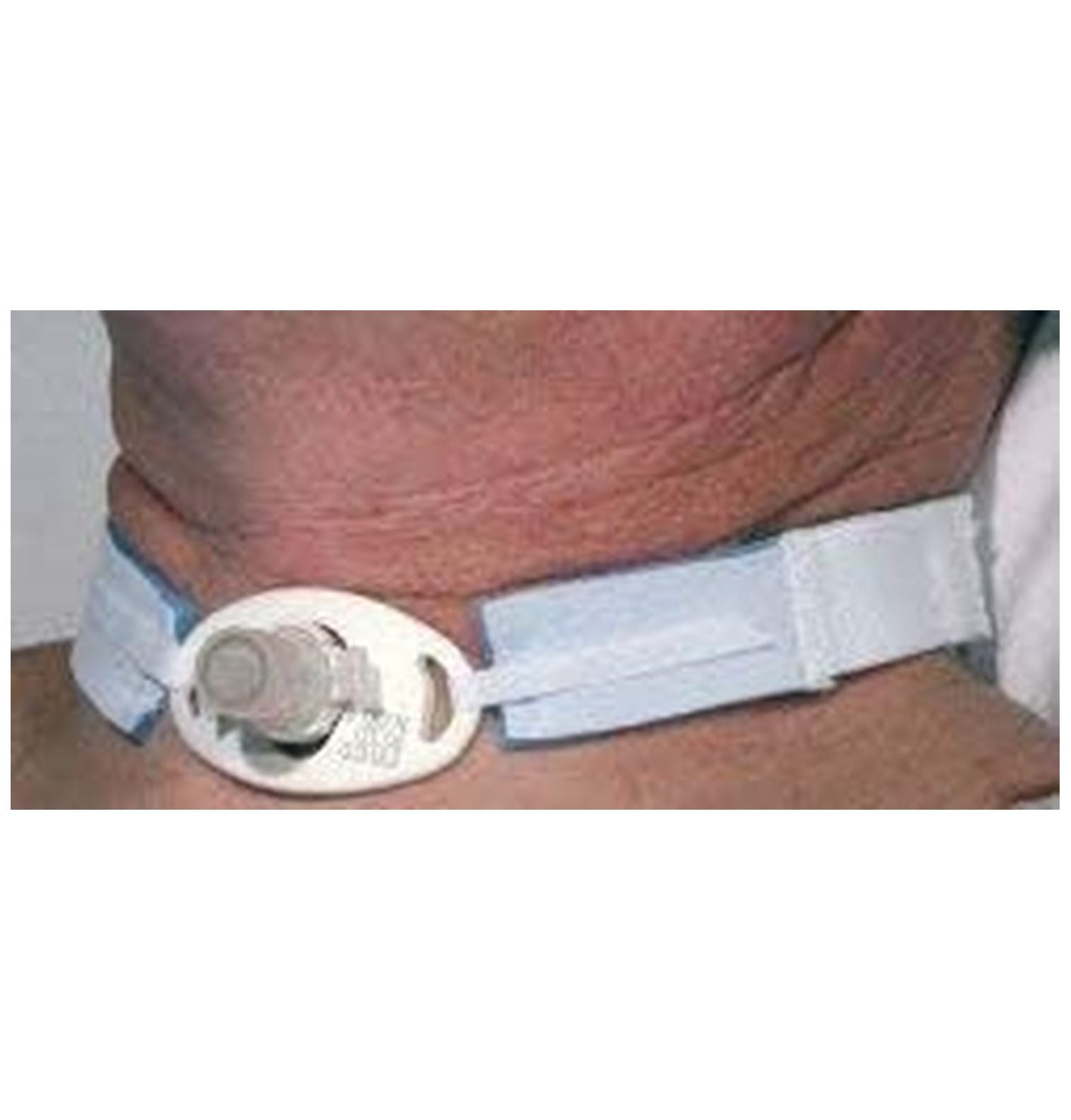 AirLife Tracheostomy Tube Holder, RES240A - Box of 10 - Walmart.com