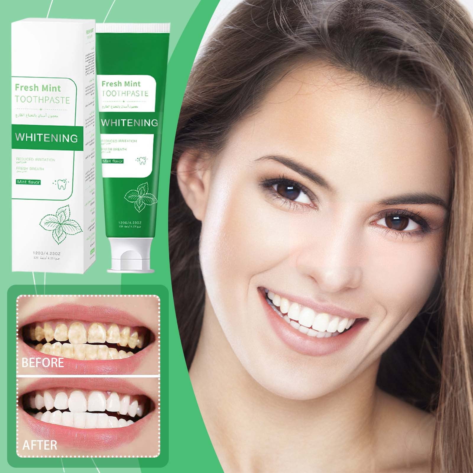 Alaparte 120g Fresh Mint Toothpaste In Oral Cleaning Whitening and ...