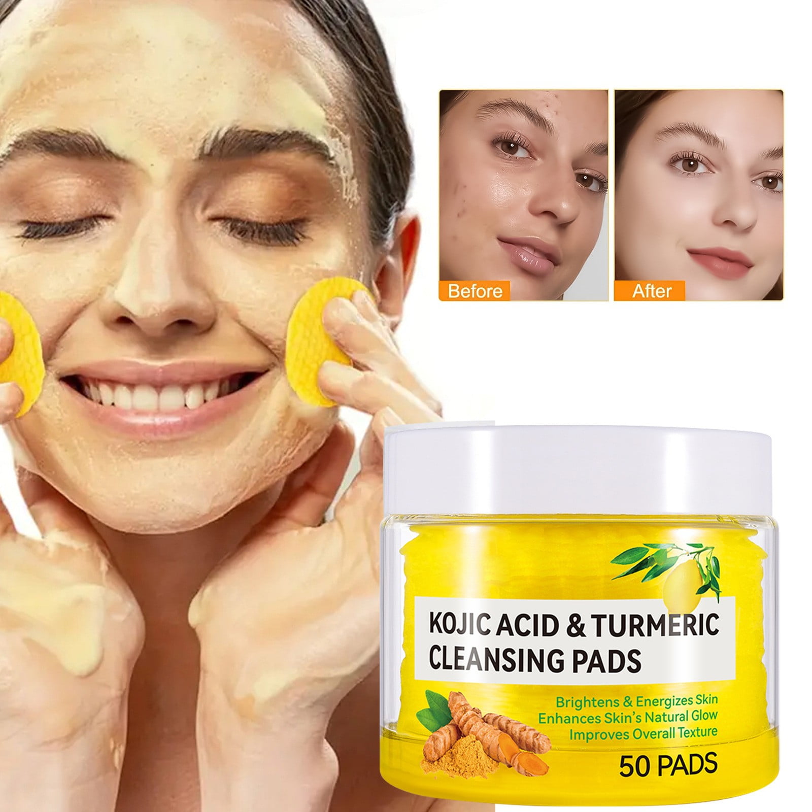 Alaparte,Turmeric Kojic Cleansing Pads For Face Body Vitamin B5 Fades ...