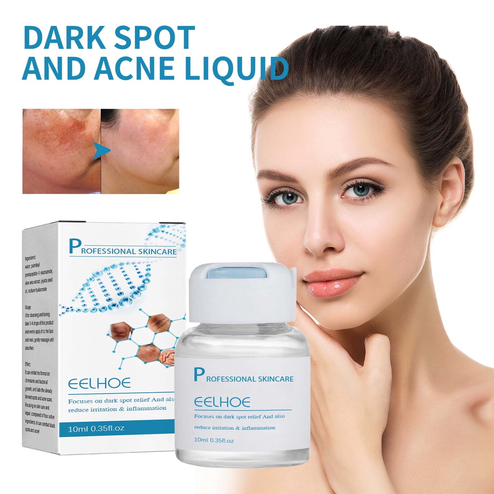 Alaparte, Whitening And Removing, Moisturizing And Whitening, Removing ...