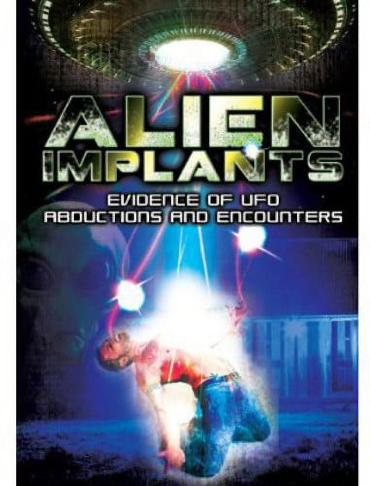 Alien Implants: Evidence of UFO Abductions & Encou (DVD), MVD (Generic ...