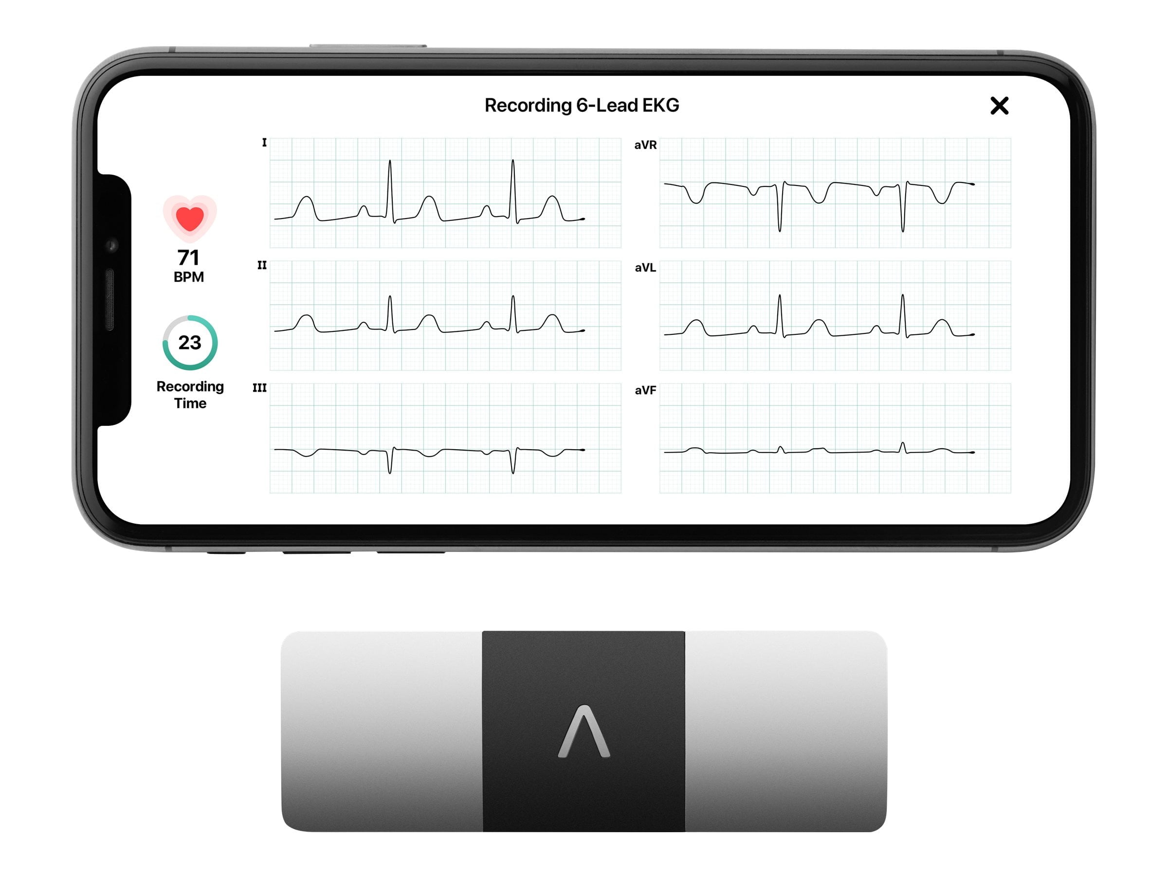 AliveCor, KardiaMobile 6L EKG Heart Monitor, 6-Lead medical grade EKG ...