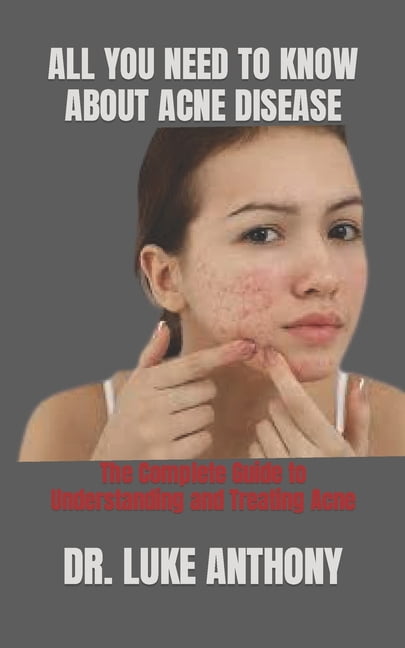 All You Need to Know about Acne Disease : The Complete Guide to ...