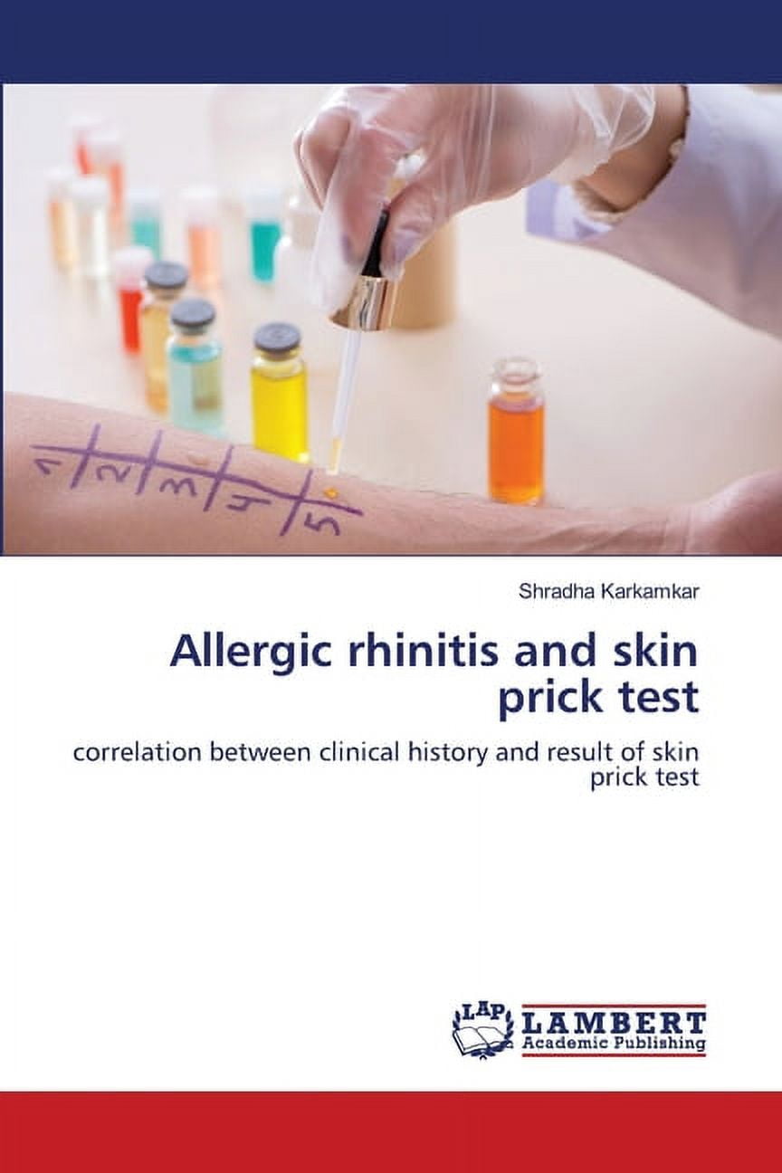 Allergic rhinitis and skin prick test (Paperback) - Walmart.com