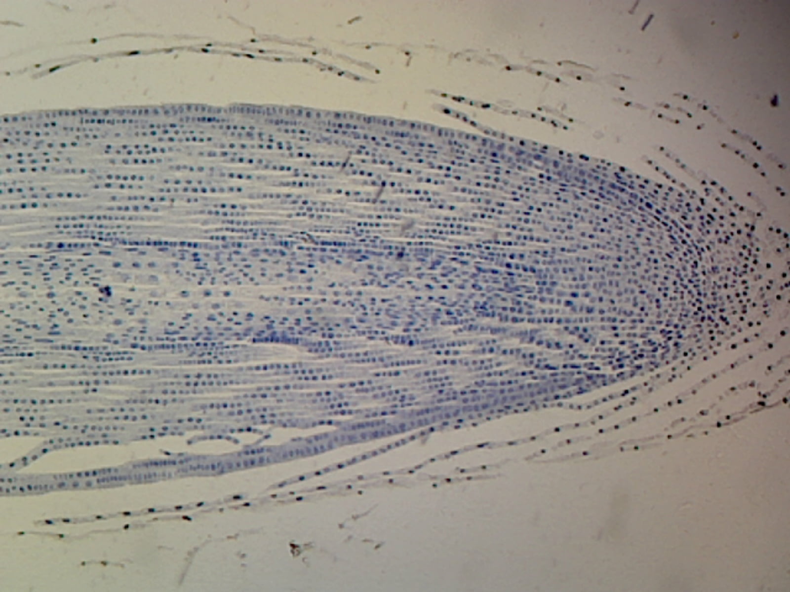 Slide, Allium Root Tip Typical Monocot Root; Longitudinal Section ...